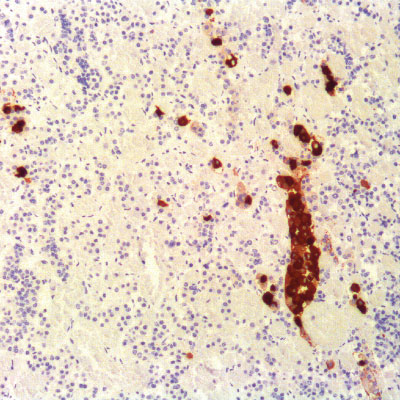 Anatomical pathology instruments - Vitro master diagnóstica