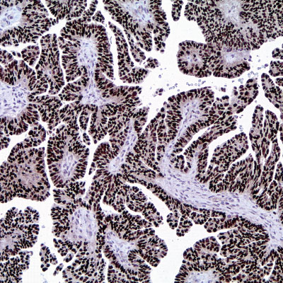 Anatomical pathology instruments - Vitro master diagnóstica