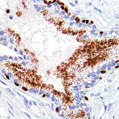 Anatomical pathology instruments - Vitro master diagnóstica