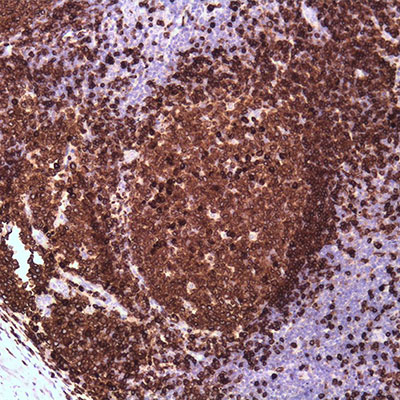 Detection systems - Vitro master diagnóstica